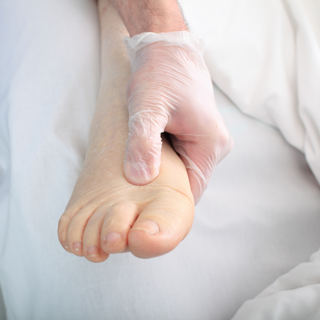 Edema de Membros Inferiores | Clínica Dr. Ronaldo Daudt